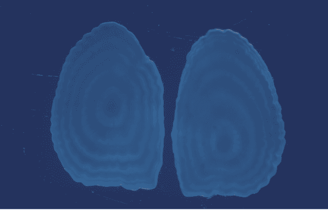 Fish Otoliths - iMagine project